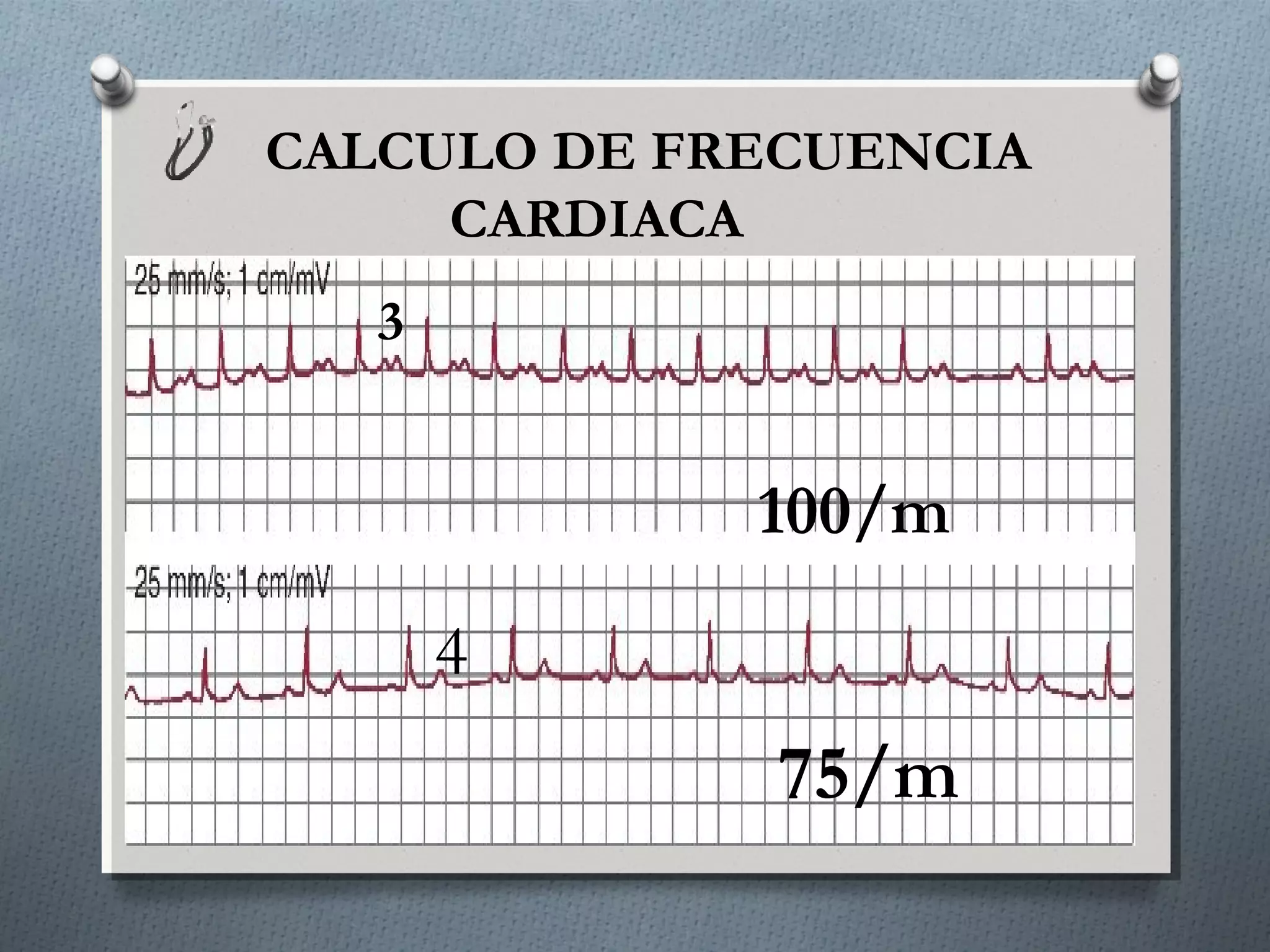 Electrocardiografia basica y signos de alarma ( Autores Lic.Ojeda David ...