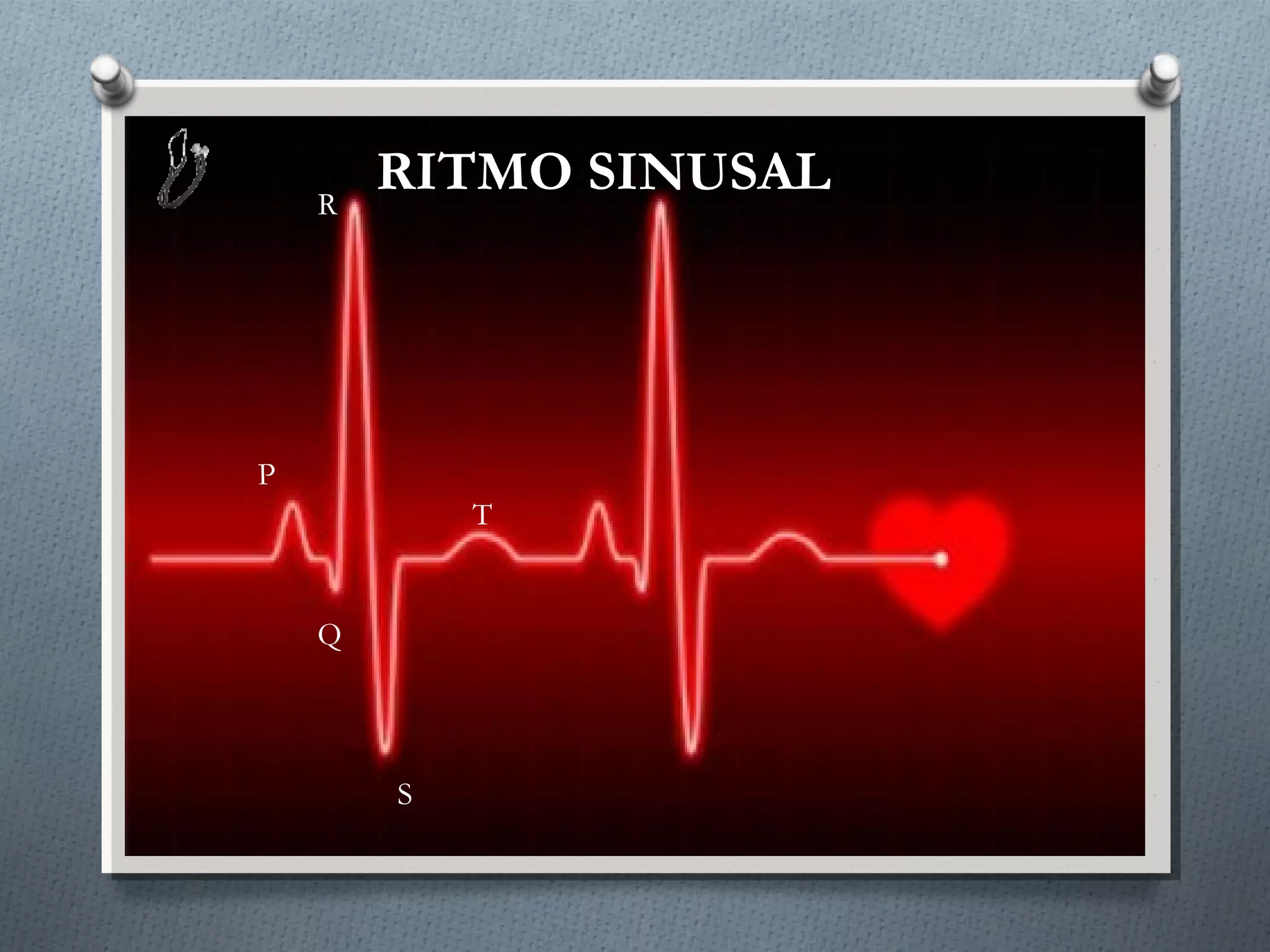 Electrocardiografia basica y signos de alarma ( Autores Lic.Ojeda David ...
