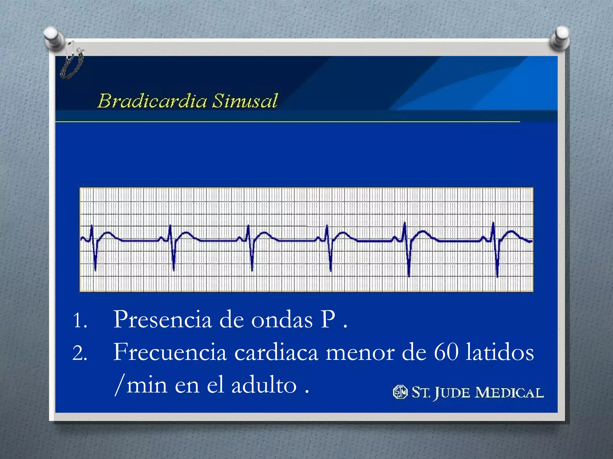 Electrocardiografia basica y signos de alarma ( Autores Lic.Ojeda David ...