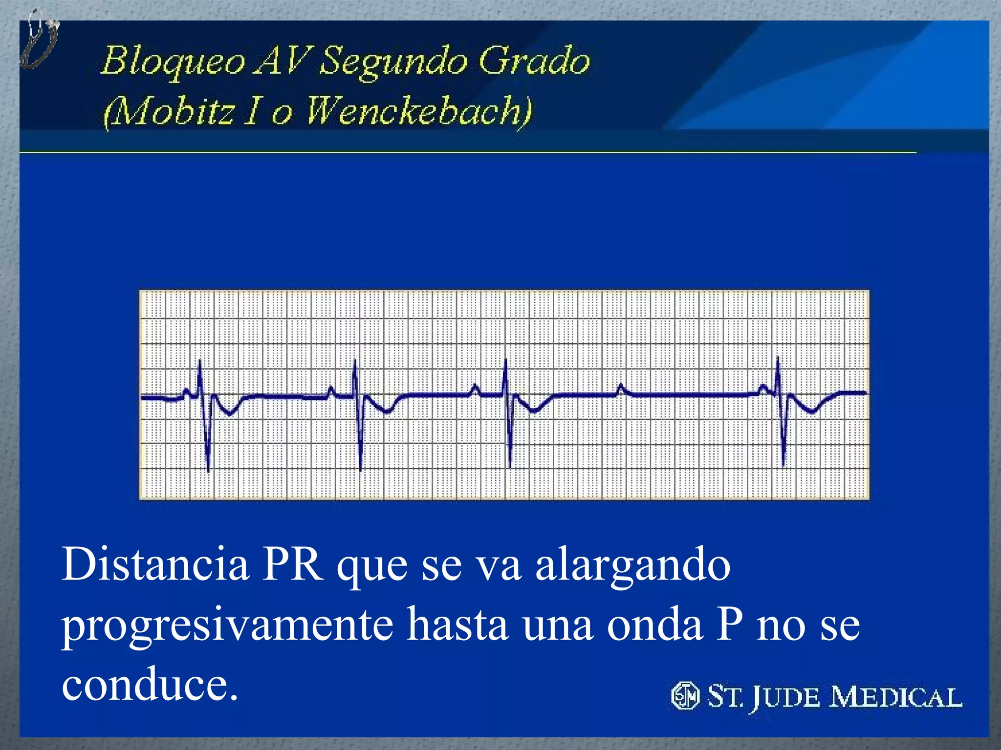 Electrocardiografia basica y signos de alarma ( Autores Lic.Ojeda David ...