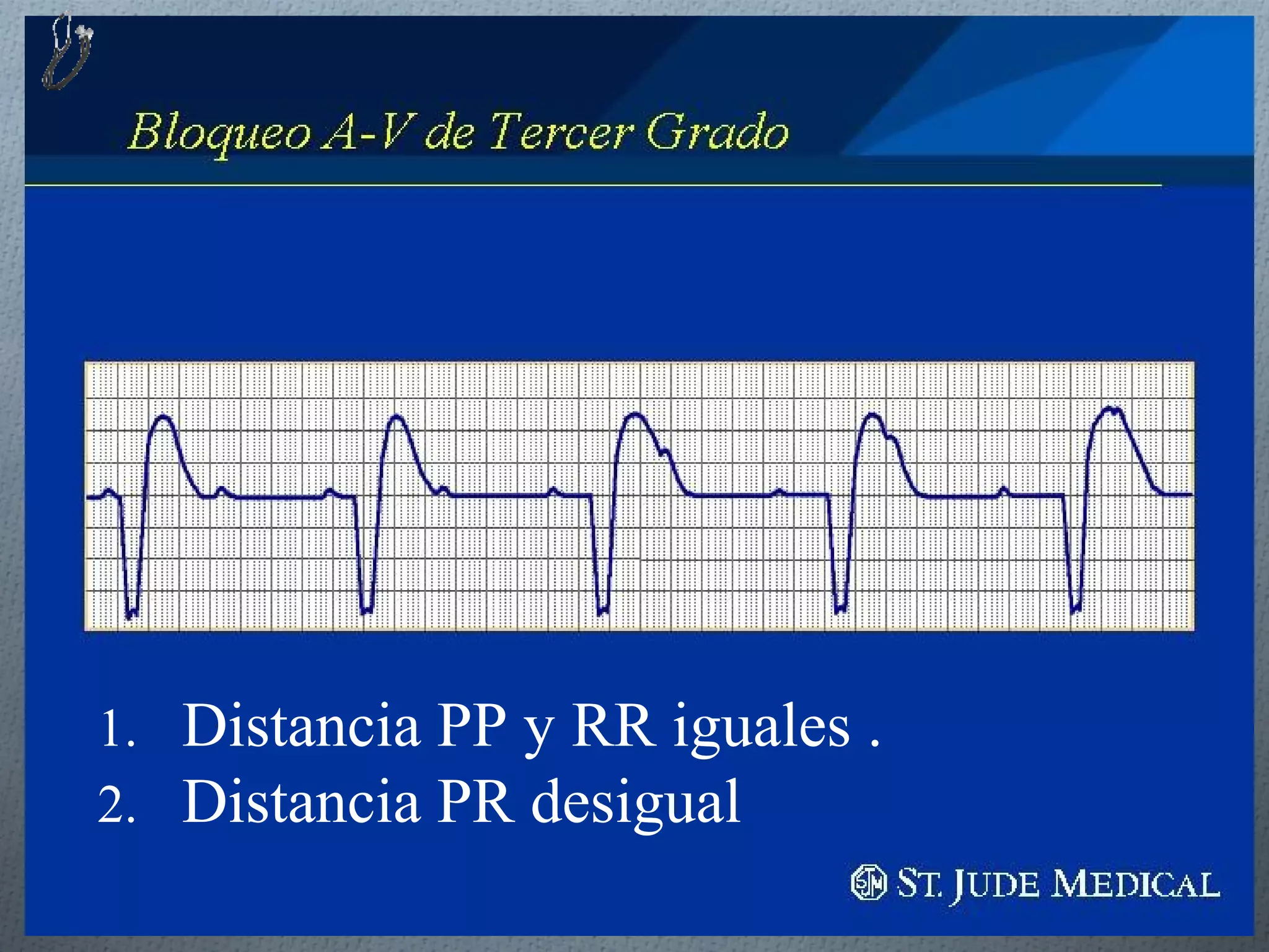 Electrocardiografia basica y signos de alarma ( Autores Lic.Ojeda David ...