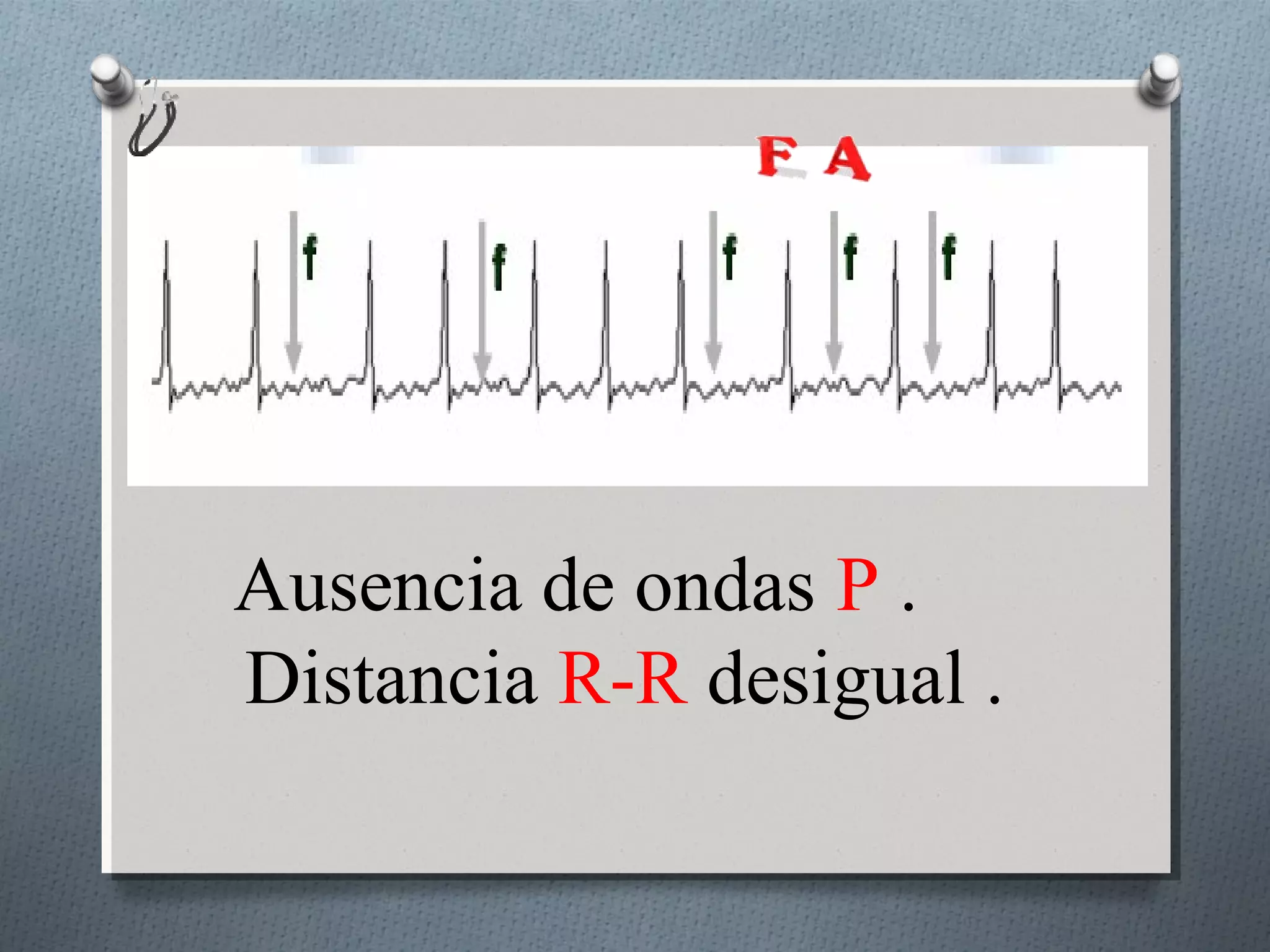 Electrocardiografia basica y signos de alarma ( Autores Lic.Ojeda David ...