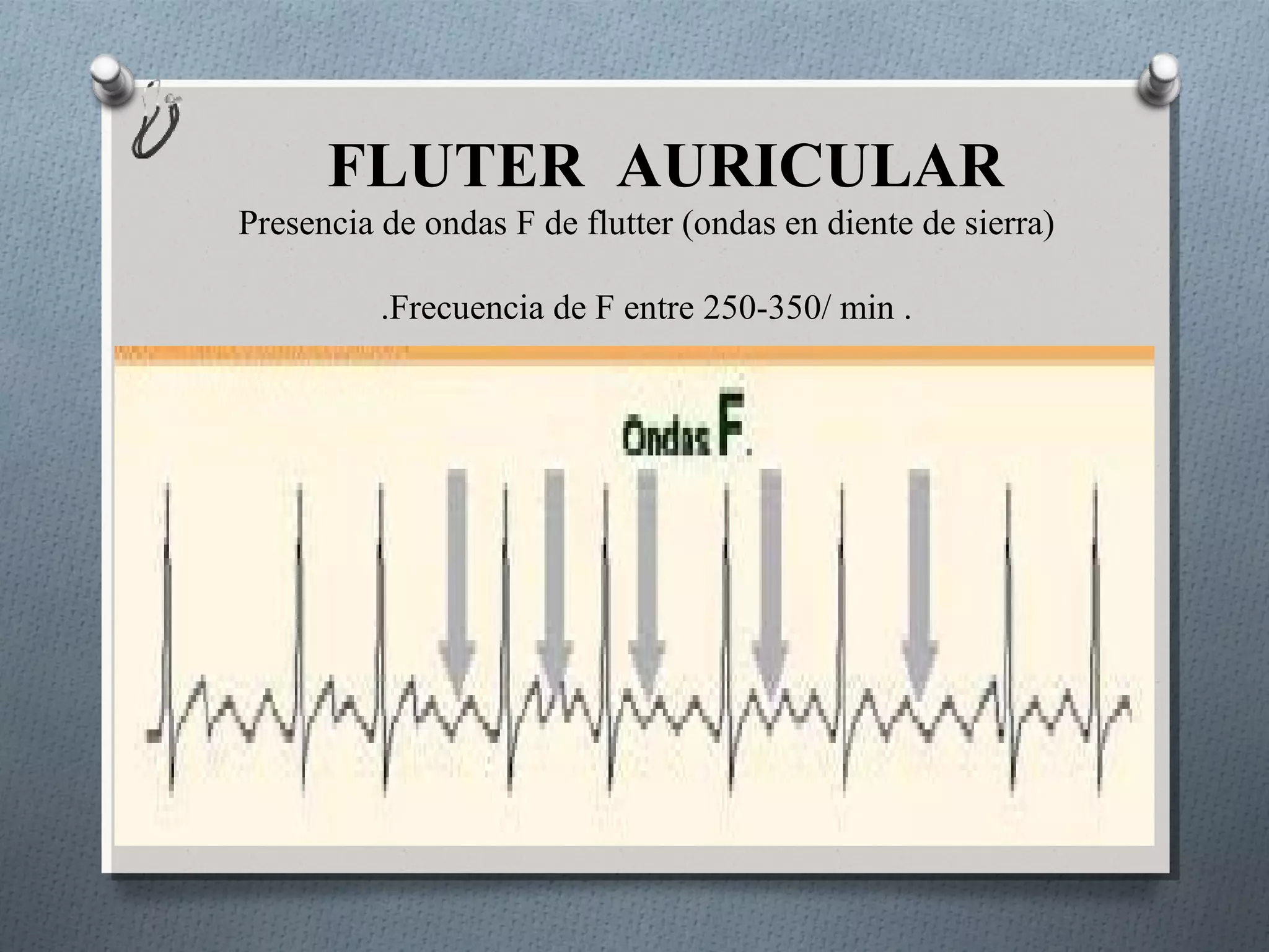 Electrocardiografia basica y signos de alarma ( Autores Lic.Ojeda David ...