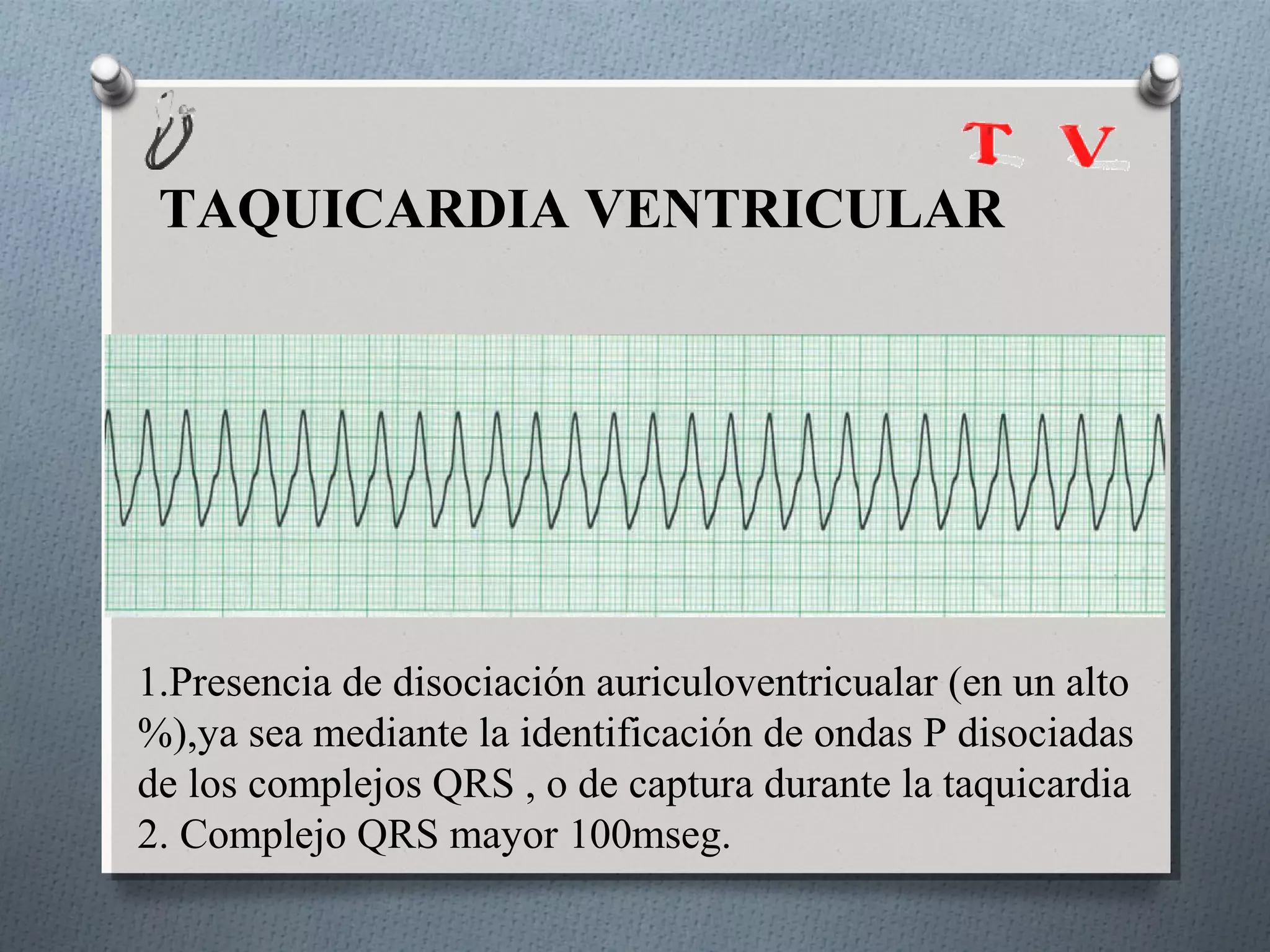 Electrocardiografia basica y signos de alarma ( Autores Lic.Ojeda David ...