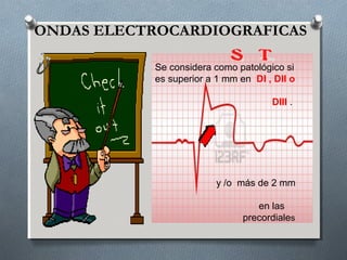 Electrocardiografia basica y signos de alarma ( Autores Lic.Ojeda David ...