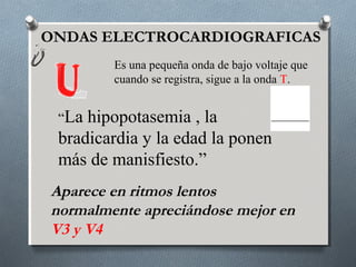 Electrocardiografia basica y signos de alarma ( Autores Lic.Ojeda David ...