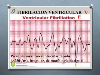 Electrocardiografia basica y signos de alarma ( Autores Lic.Ojeda David ...