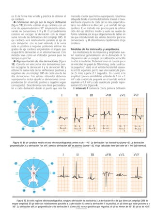 Electrocardiografia consulta | PDF