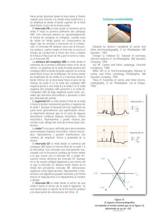 Electrocardiografia consulta | PDF
