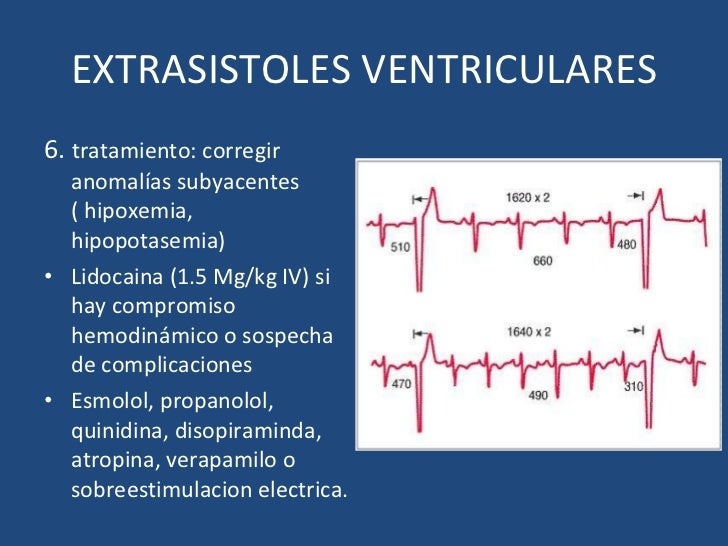 Electrocardiografia intraoperatoria 1