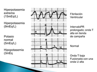 electrocardiografia V.pptx