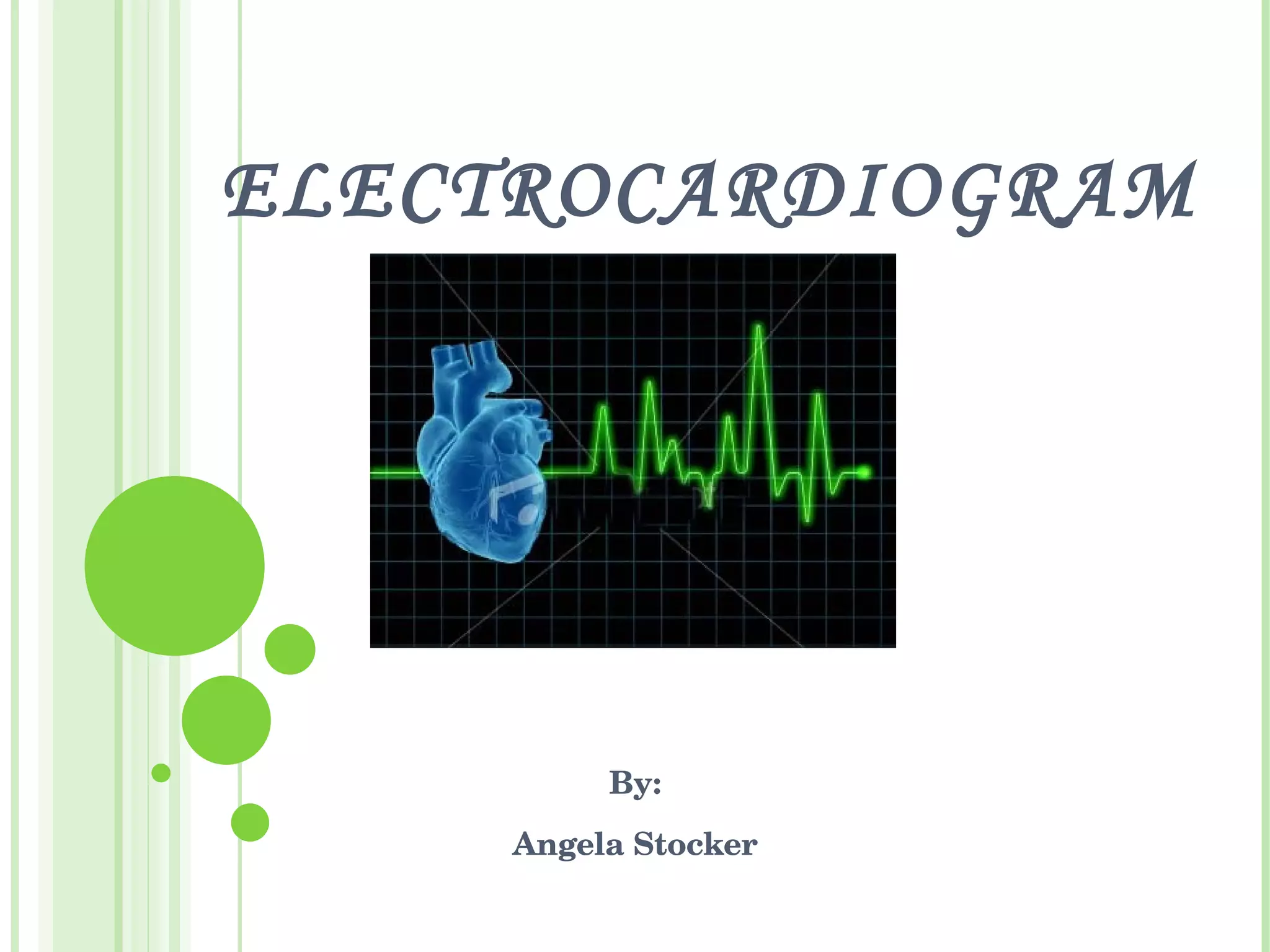 Electrocardiogram | PPT