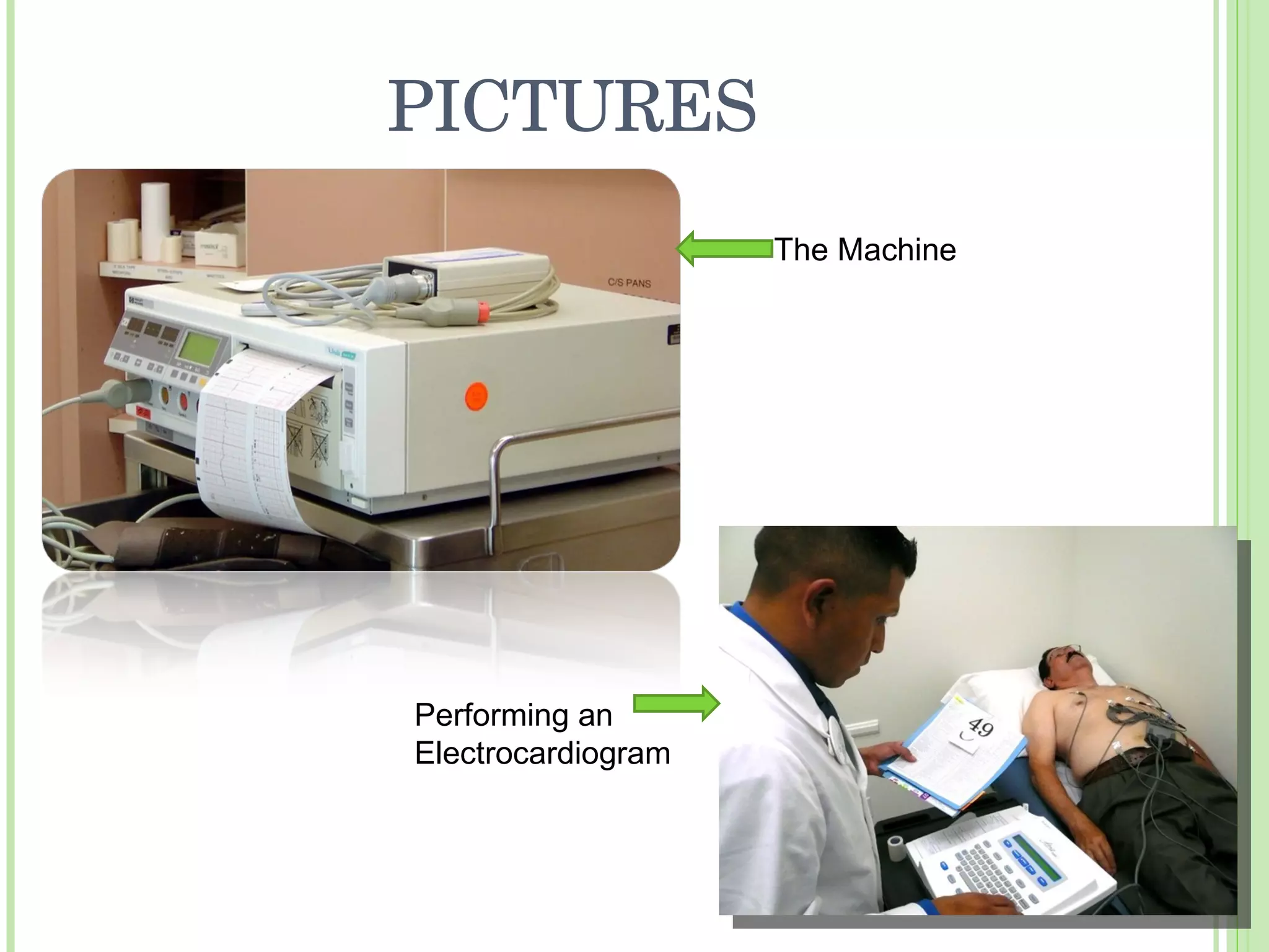 Electrocardiogram | PPT