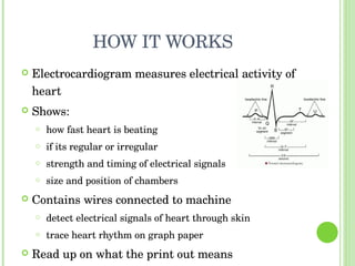 Electrocardiogram | PPT