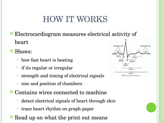 Electrocardiogram | PPT