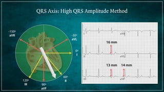 Electrocardiogram | PDF