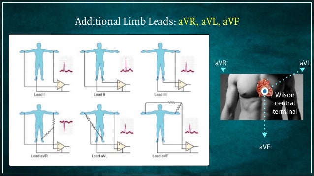Electrocardiogram Electrocardiogram