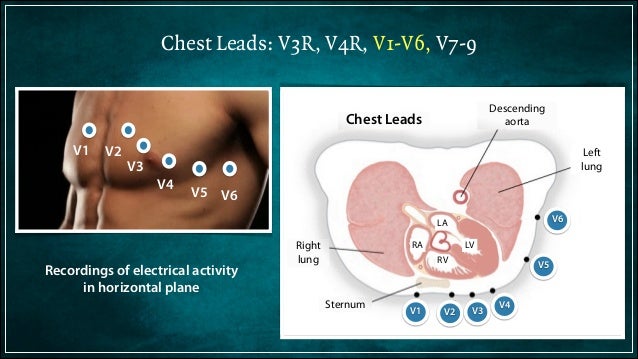 Electrocardiogram
