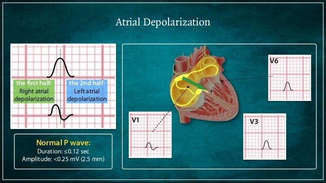 Electrocardiogram