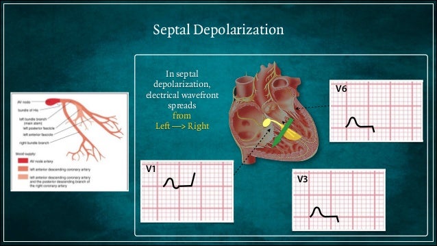 Electrocardiogram