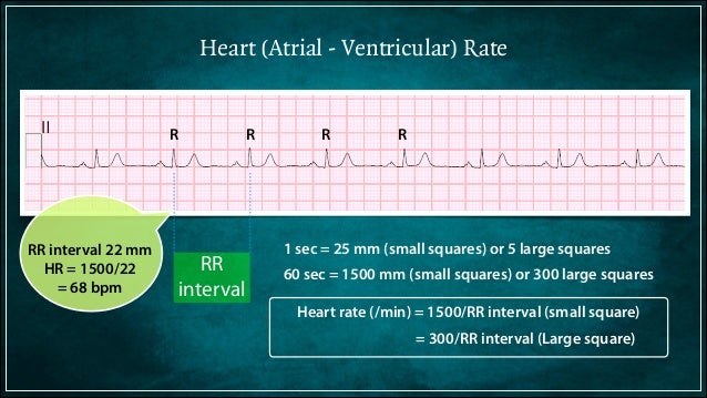 Electrocardiogram