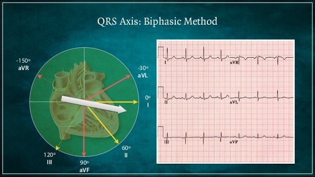Electrocardiogram
