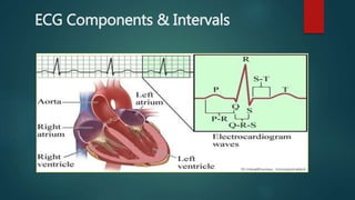 Electrocardiogram | PPT