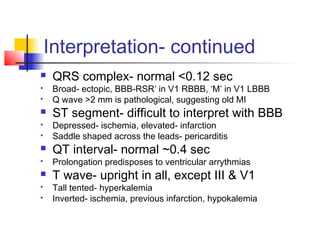 Electrocardiogram | PPT