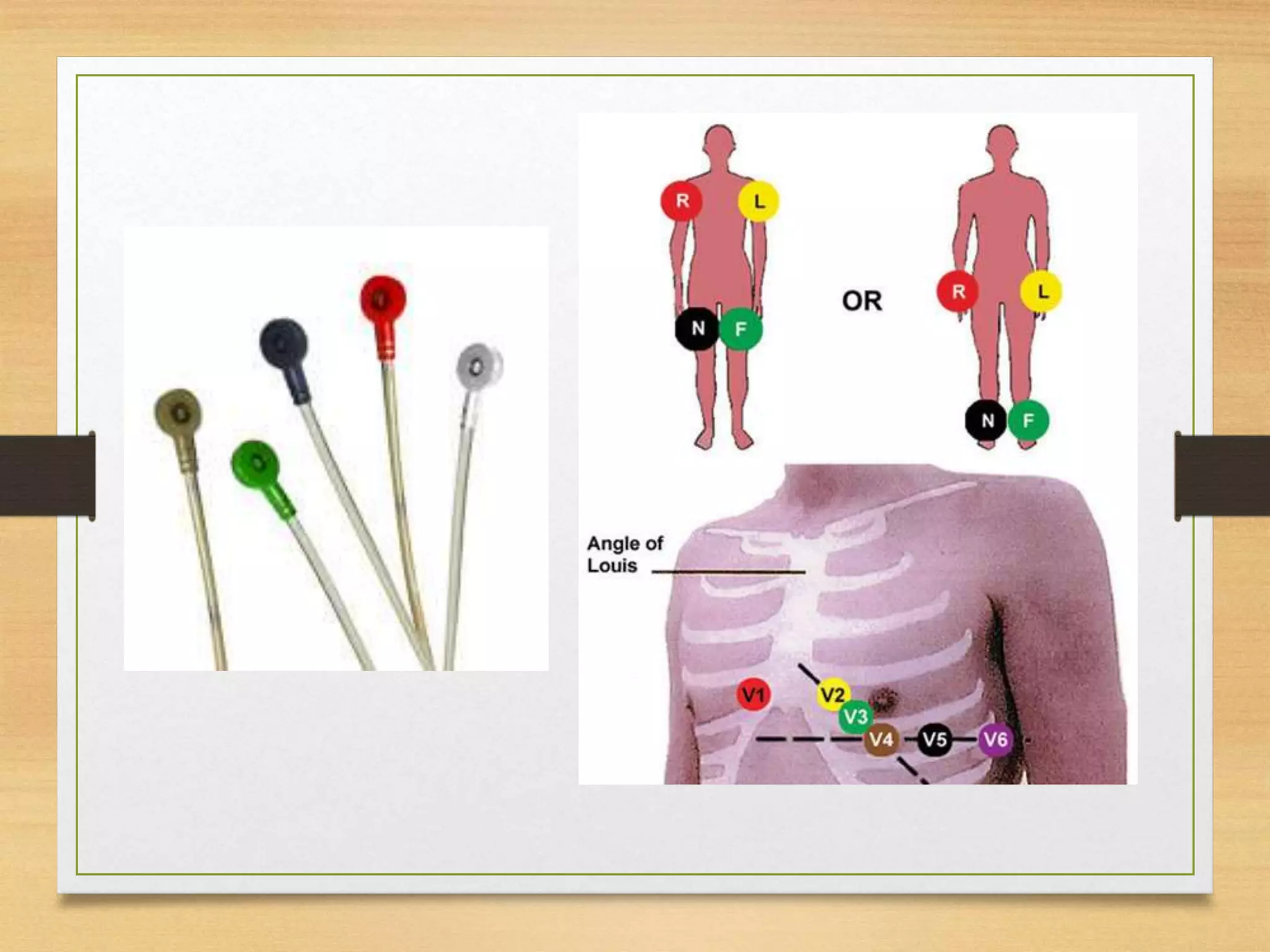 Electrocardiogram | PPTX