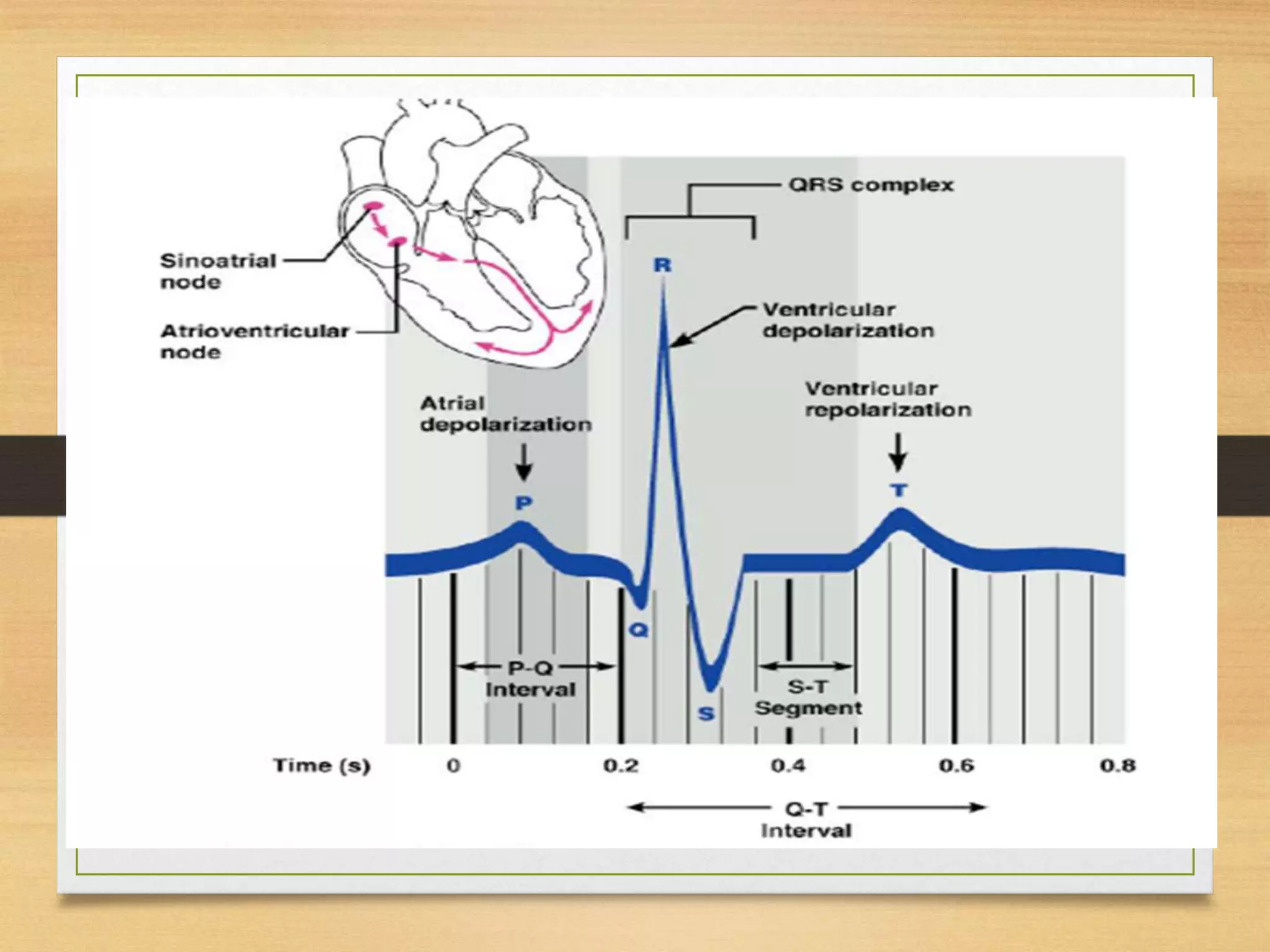 Electrocardiogram | PPTX