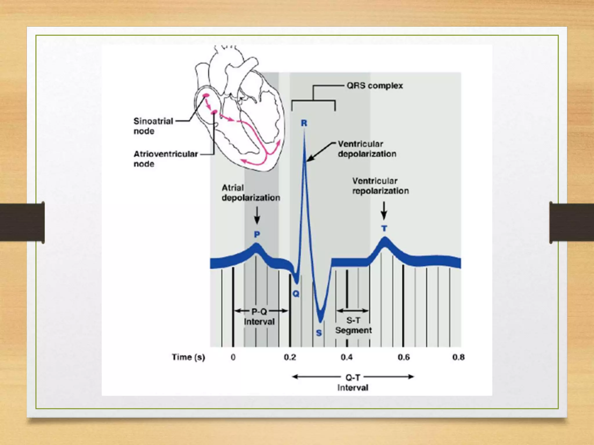 Electrocardiogram | PPTX