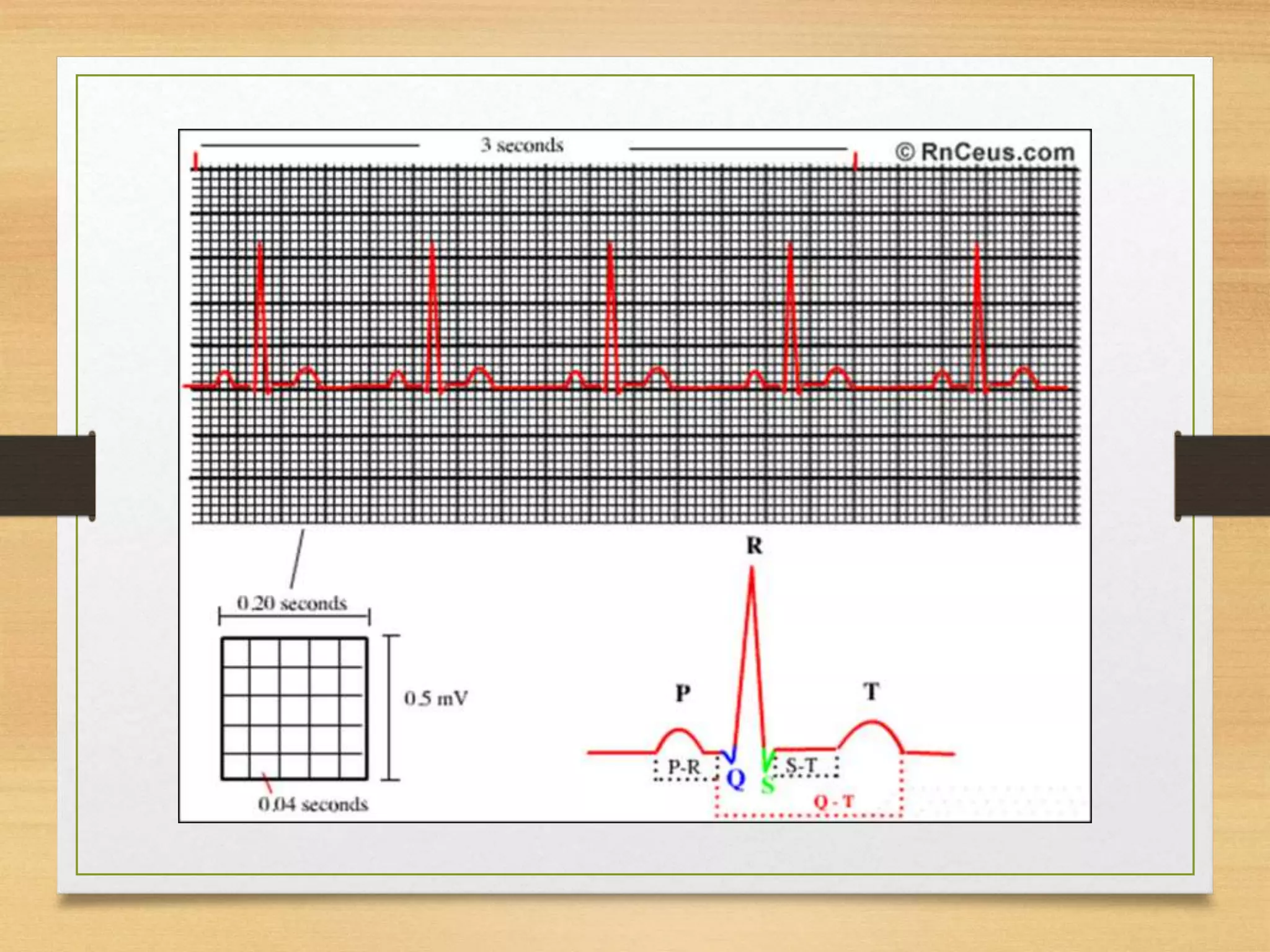 Electrocardiogram | PPTX