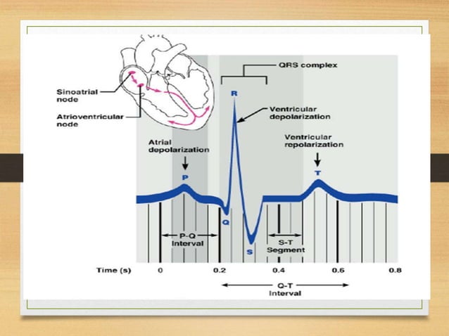 Electrocardiogram | PPTX