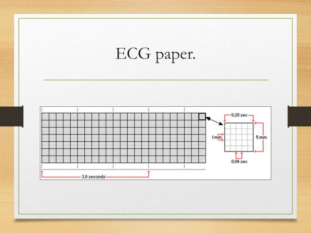 Electrocardiogram | PPTX
