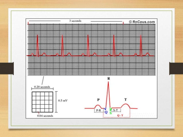 Electrocardiogram | PPTX