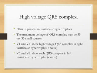 Electrocardiogram | PPT