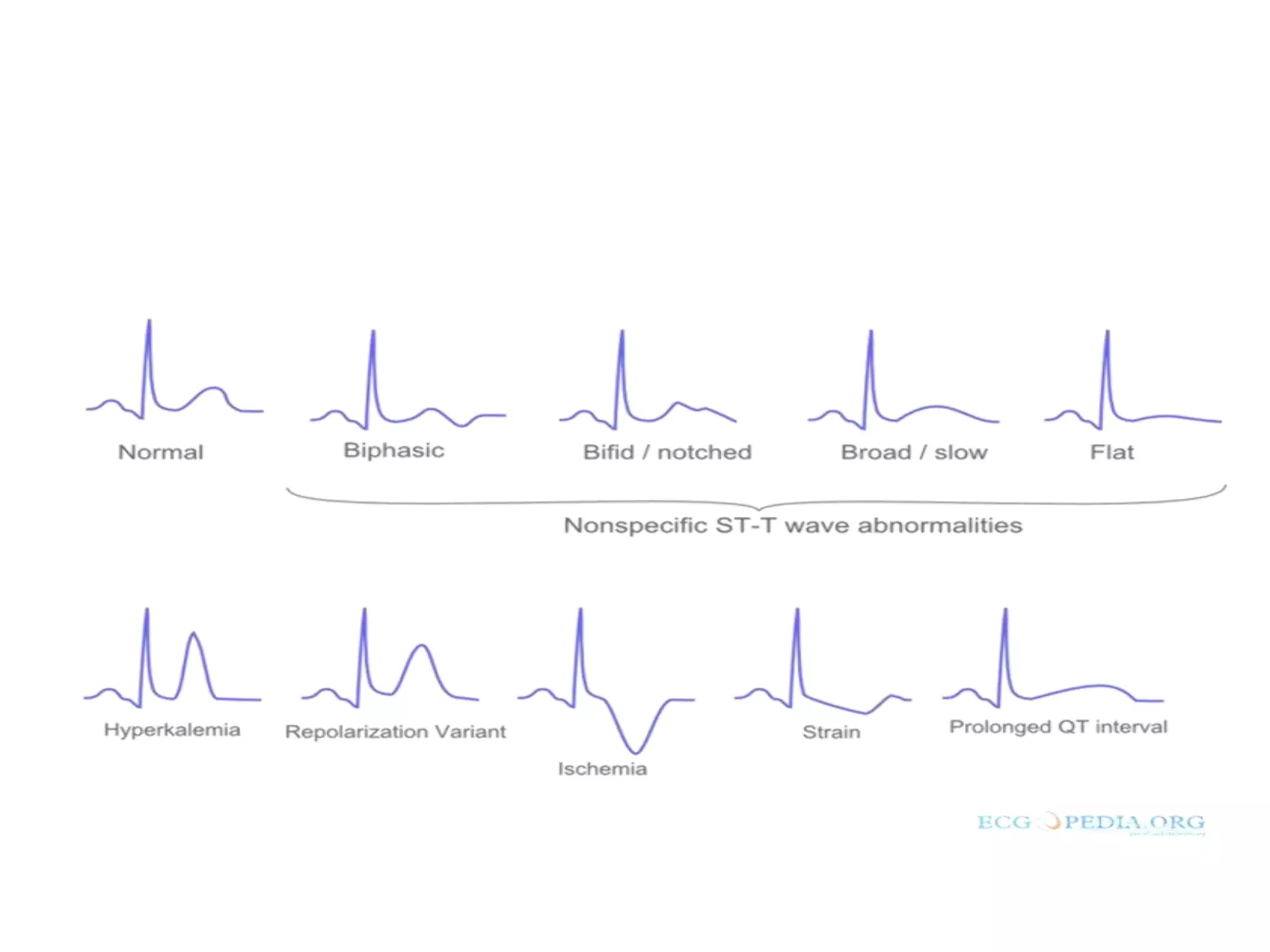 Electrocardiogram (ECG) / ECG interpretation | PPTX