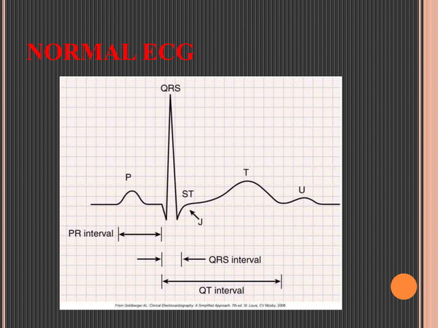 Electrocardiogram (ECG) / ECG interpretation | PPTX