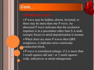 Electrocardiogram (ECG) / ECG interpretation | PPTX