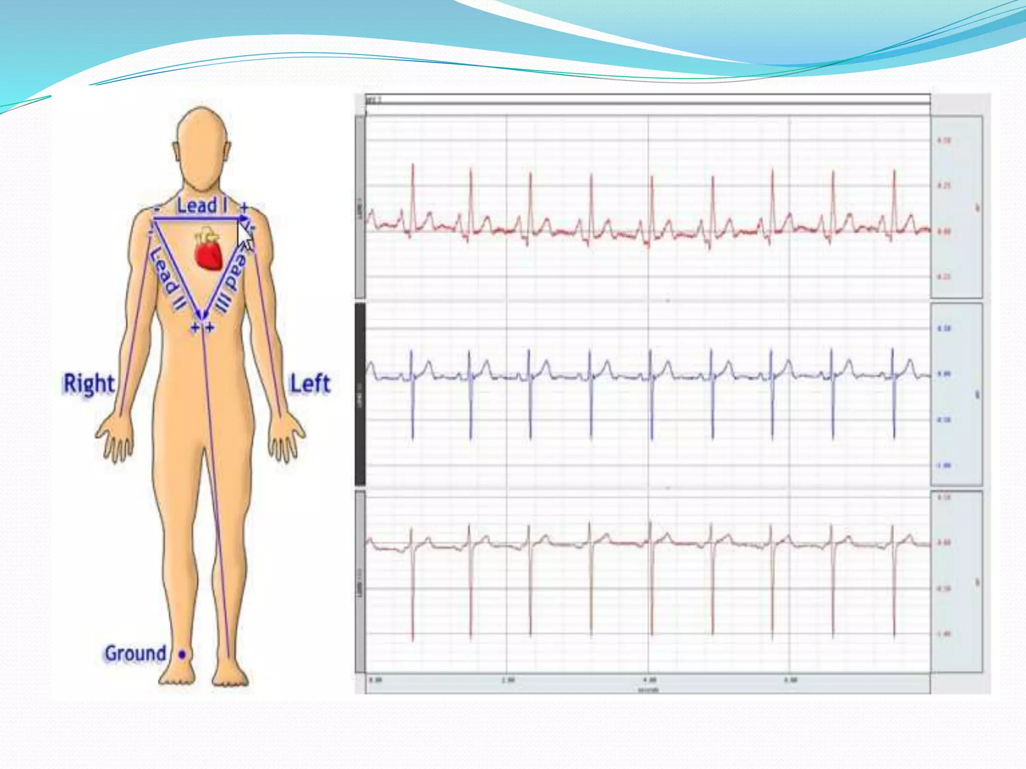 Electrocardiogram | PPTX