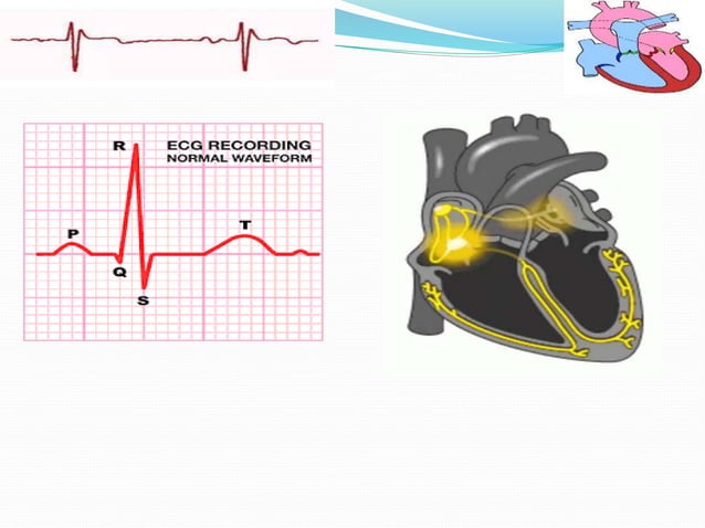 Electrocardiogram | PPTX