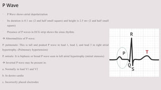 ELECTROCARDIOGRAM (ECG) | PPT