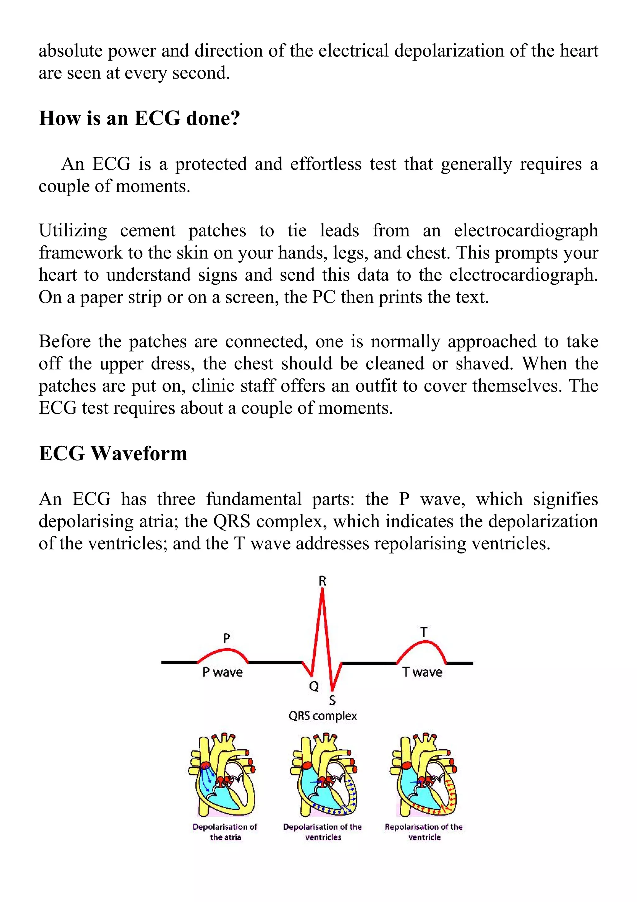 ECG - Definition and Measurement techniques .pdf