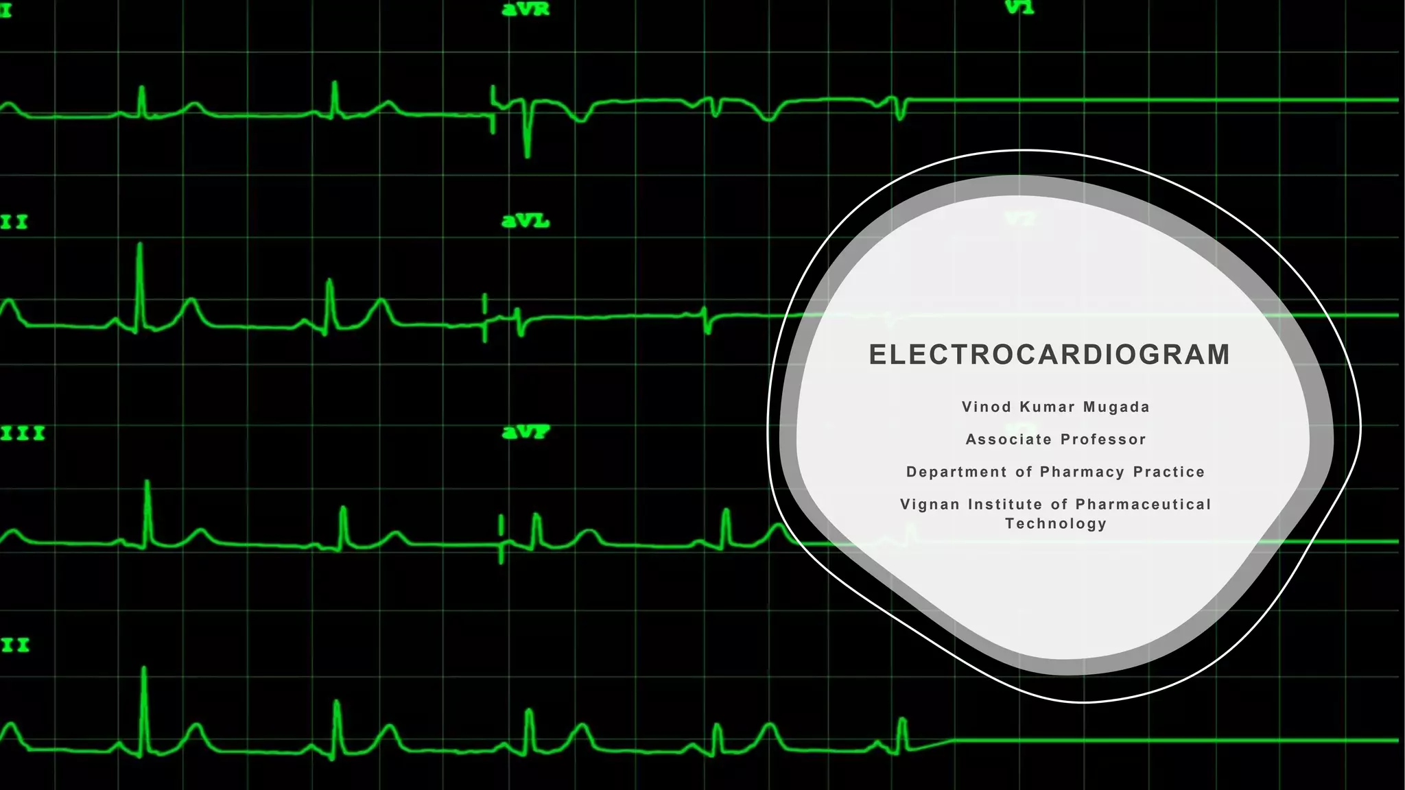 ELECTROCARDIOGRAM.pptx