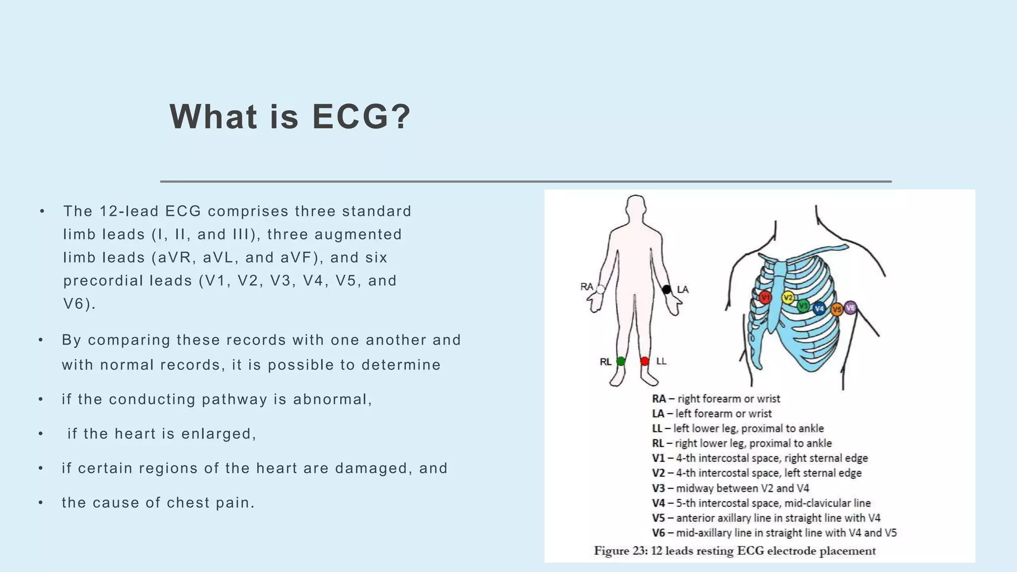 ELECTROCARDIOGRAM.pptx