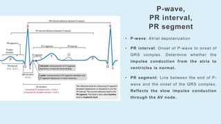 ELECTROCARDIOGRAM.pptx
