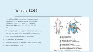 ELECTROCARDIOGRAM.pptx