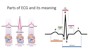 Electrocardiogram muhimbili hospital ppt | PPTX