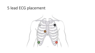 Electrocardiogram muhimbili hospital ppt | PPTX