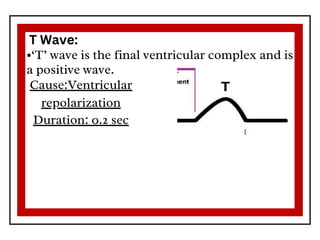 Electrocardiogram_20240614_173859_0000.pdf
